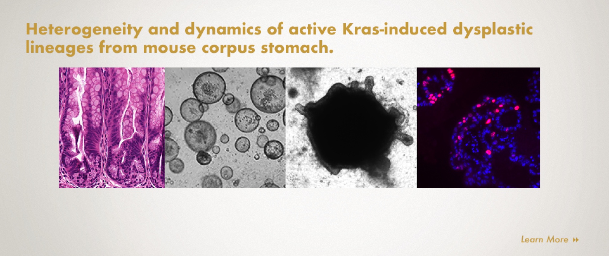 Choi Lab | Vanderbilt Surgical Research